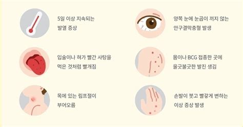 385도 이상 고열 5일 넘게 안 떨어지는 ‘이 병··· 5세 미만 특히 주의