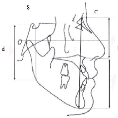 Vertical And Horizontal Dimension Measurement Methods Of Sivakumar And Download Scientific