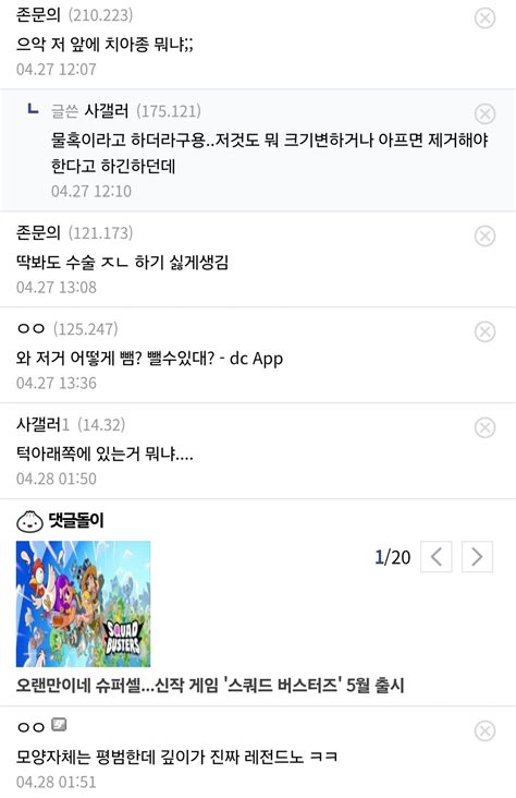 디시의 사랑니 레전드 ㄷㄷㄷ 유머 움짤 이슈 에펨코리아