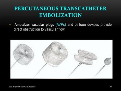 Pulmonary Interventional Radiology Techniques