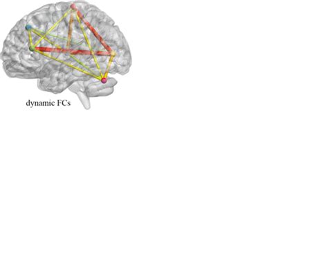constructing multi view high order functional connectivity networks for diagnosis of autism