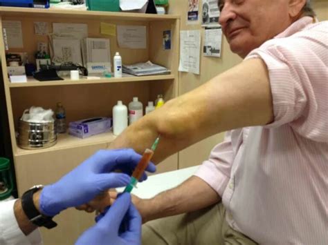 Bursitis En El Codo Causas Síntomas Y Tratamiento Blog Clínica