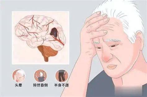 脑供血不足的人，一般有4个症状！松开这3处，供血好了，头也轻松了大脑手指影响