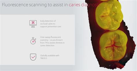Trios 5 The New Intraoral Scanner By 3shape Has Just Launched
