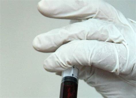 Pruebas Sexuales Que Debes Realizarte