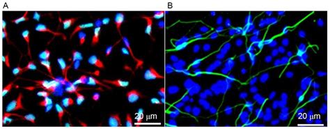 Primary Neurons After 10 Days In Culture A Immunofluorescence
