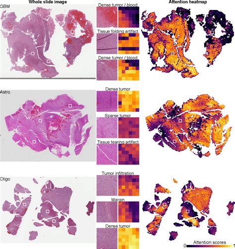 Figure From A Self Supervised Framework For Learning Whole Slide Representations Semantic