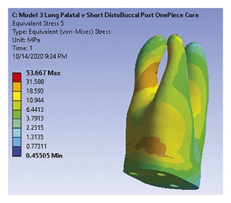 A Stress Distribution Pattern In Dentin Under 480 N Along Model 3 Download Scientific