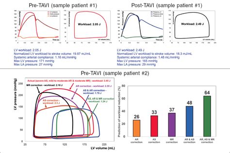 Ventricular Pressure Volume Loop And Other Heart Function Metrics Can Elucidate Etiology Of