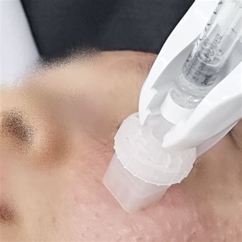 환절기 손상된 피부장벽 나에게 더 잘 맞는 스킨 부스터는 성수동 피부과 물광주사 리쥬란힐러 차이 네이버 블로그