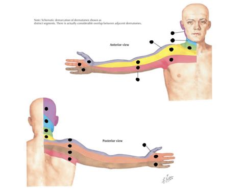 Dermatomes Upper Limb