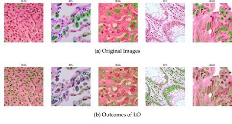 Figure 1 From A Novel Heteromorphous Convolutional Neural Network For Automated Assessment Of