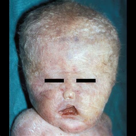 Newborn With Abnormal Facies Pediatric Radiology Case Pediatric