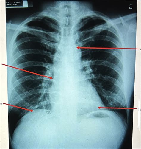 Aandp2 Practical 1 Lab 3 Slide 3 Diagram Quizlet