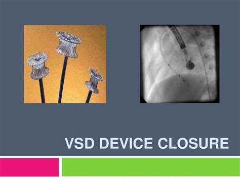 Vsd Device Closure