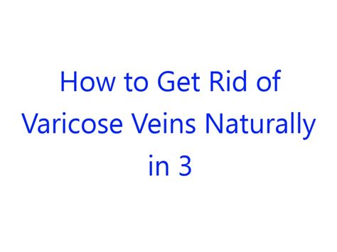 How To Get Rid Of Varicose Veins Naturally In 3 Minutes