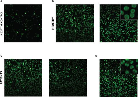 Immunofluorescence Slides At Salvador Kress Blog