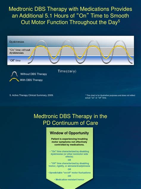Dbs Pd Presentation Pdf
