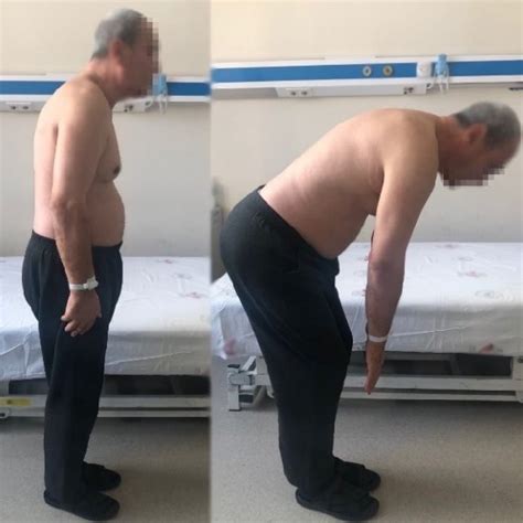 Anteroposterior Ap Radiograph Of The Pelvis Shows Calcification Of Download Scientific