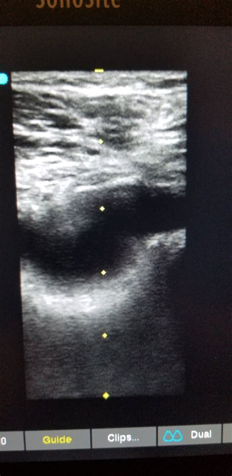 Fujifilm Sonosite Sonosite Twitter