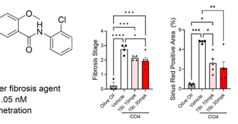 韓 연구진 간 섬유화 신약 후보물질 찾았다