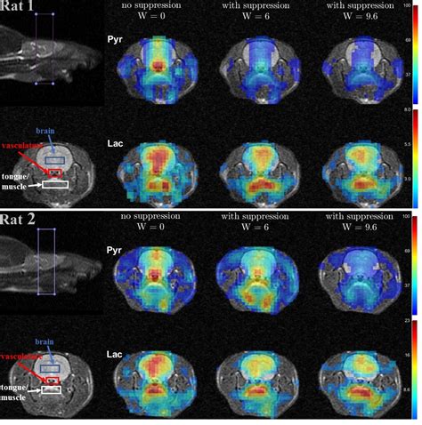 1 Diagnostic Radiology And Nuclear Medicine University Of Maryland Baltimore Baltimore Md