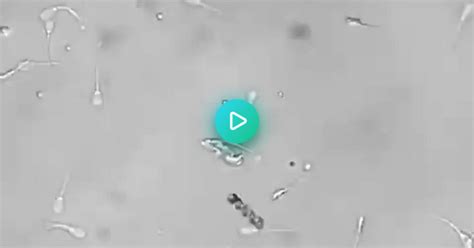 A Microbot Grabbing A Sperm And Carrying It To An Egg Album On Imgur