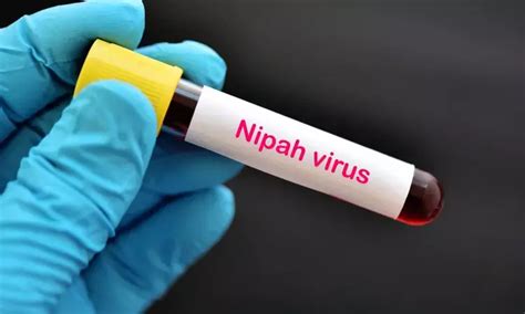 Kerala Nipah Virus One More Test Result Negative 268 On Contact List