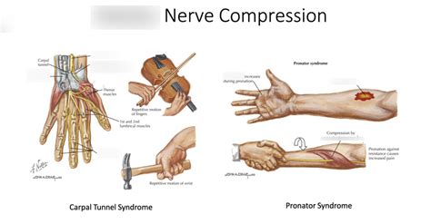 Median Nerve Compression Study Set Key Biology Terms Flashcards Quizlet