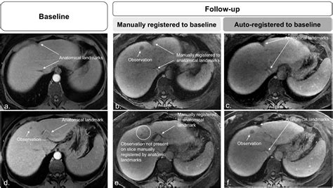 Fully Automated Convolutional Neural Network Based Affine Algorithm