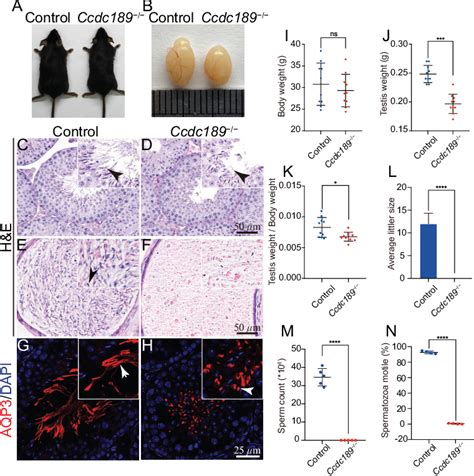 Figure 1 From Ccdc189 Affects Sperm Flagellum Formation By Interacting
