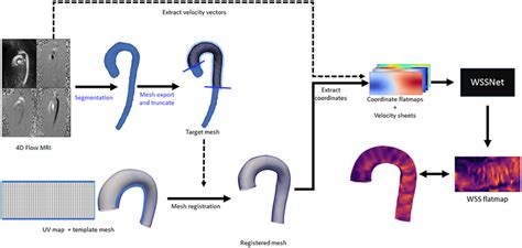 Complete Overview Of The Inference Workflow For 4d Flow Mri All The