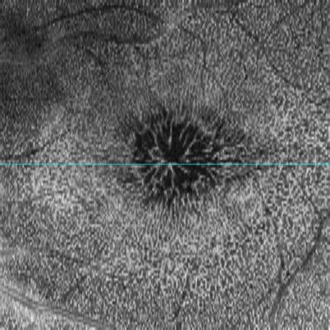 Wall Of Fame Retina Rocks Image Gallery Archive