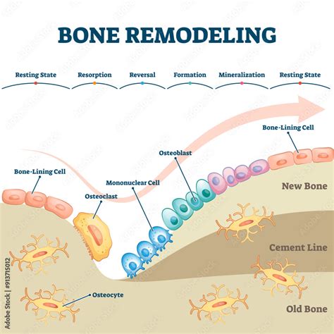 Bone Remodeling Process Educational Explanation With Labeled Structure