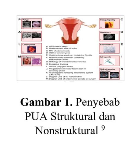 Kenali Penyebab Pendarahan Miss V Siloam Hospitals Silampari Edukasi Tatalaksana Gejala Dan