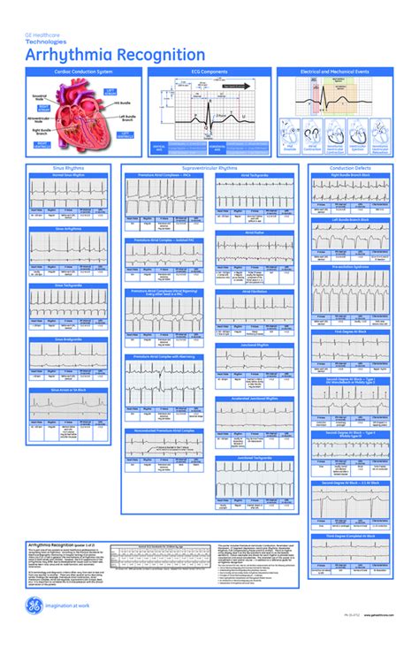 Ekg Cheat Sheet Nurses Otosection