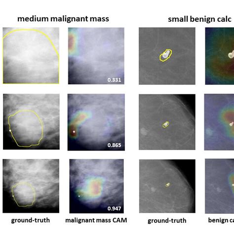 class activation maps extracted from the last convolutional layer and