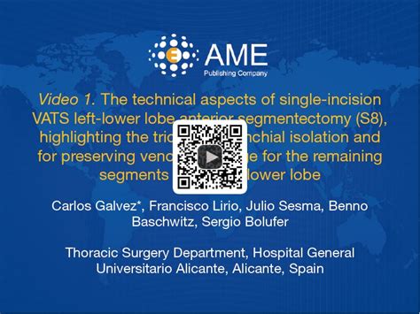 Single Incision Video Assisted Thoracoscopic Surgery Left Lower Lobe Anterior Segmentectomy S8