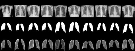 Info MGAN Is Used For Segmentation Of CXR Images Of Lungs A