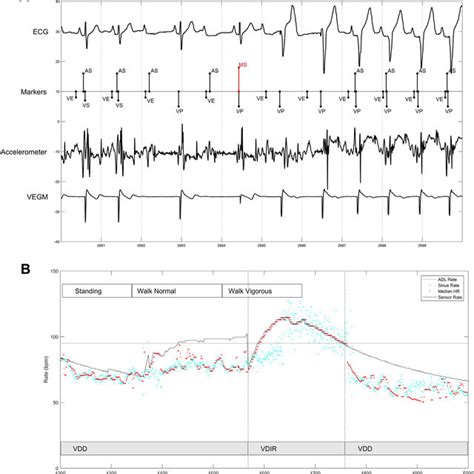 Lvot Vti During Vvi 50 And Vdd Pacing Download Scientific Diagram