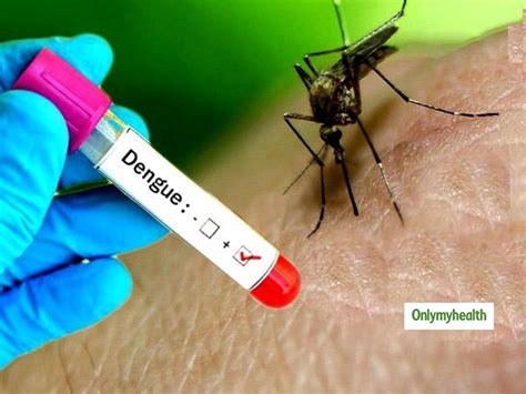 Dengue Tips Know How To Detection Of Dengue Fever In Hindi जानलेवा हो