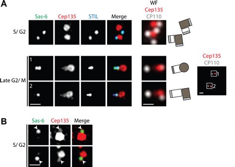 Figure 5 From 3d Structured Illumination Microscopy Provides Novel Insight Into Architecture Of