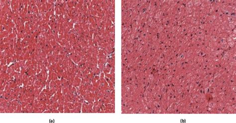 Self Attention Based Bilstm Cnn Classifier For The Prediction Of Self Attention Based Bilstm Cnn Classifier For The Prediction Of