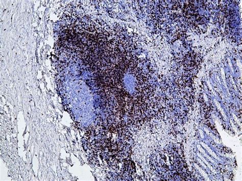 Antigen Retrieval Buffer20xcitrate Buffer Of Ph60 产品 Immunoway 中文官网 Antigen Retrieval Buffer20xcitrate Buffer Of Ph60 产品 Immunoway 中文官网