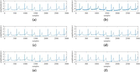 figure 6 from an ecg signal de noising approach based on wavelet energy