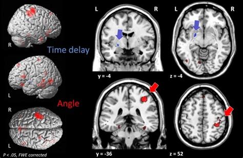 The Processing Of Spatial And Temporal Characteristics In Relation To Download Scientific