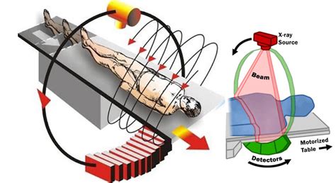 What Are Ct Scans And How Do They Work Live Science Images