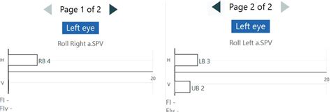 Visualeyes™ Lateral Head Roll Interacoustics