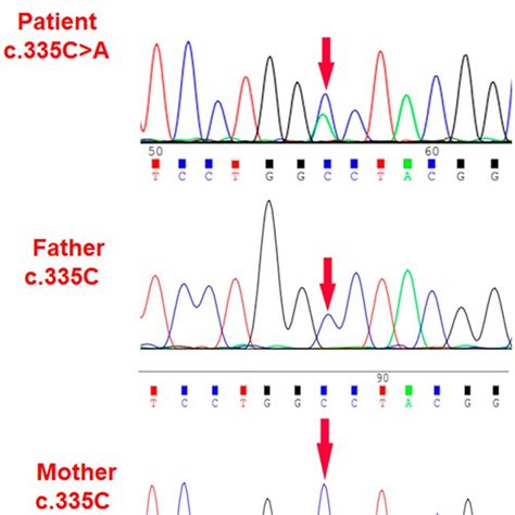Sequence Analysis Of The Pathogenic Mutation Identified In The Patient