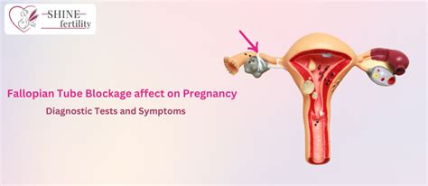 Fallopian Tube Blockage Affect On Pregnancy Diagnostic Tests And Symptoms